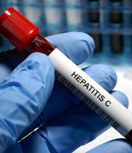 Hepatitis C: What You Should Know - Healthy Homefront